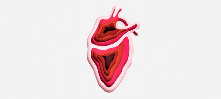 Hypokinesis Heart: Exploring Causes and Effects on Your Health